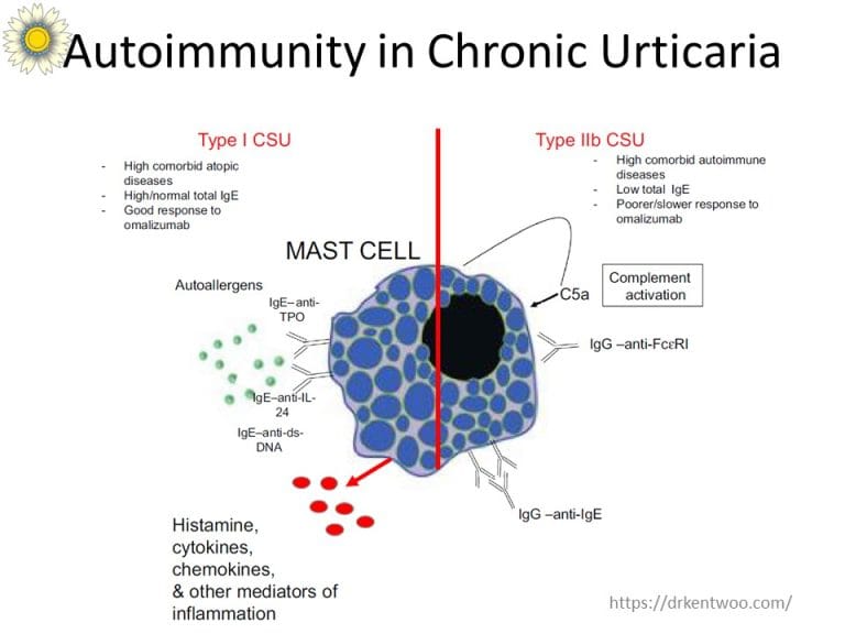 Chronic Urticaria Specialist in Malaysia — Diagnosis & Relief