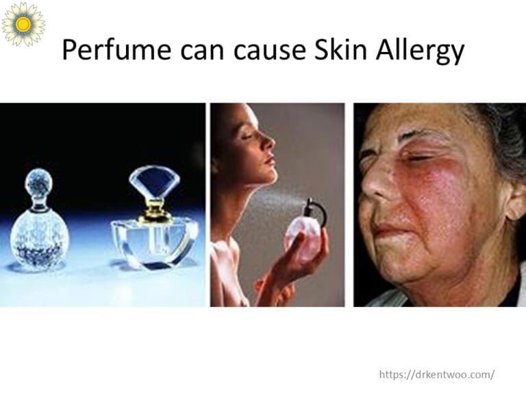 Perfume Allergy: How Fragrances Trigger Allergic Reactions in Your Skin ...