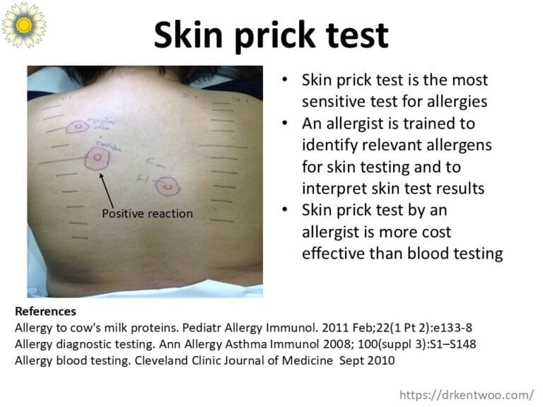 Skin Prick Test for Allergy Diagnosis: What to Know