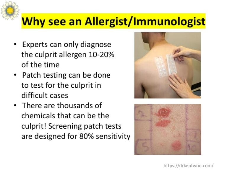 Patch Testing: Find Out What’s Causing Your Skin Allergy