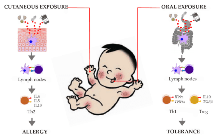 Food Allergy Prevention from Skin Sensitization - Dr Kent Woo