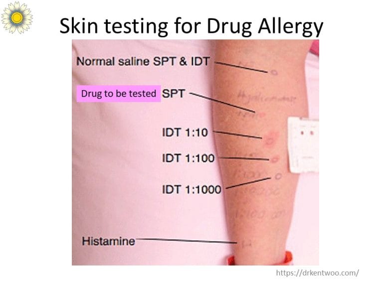 Drug Allergy Testing: How to Know If You're Truly Allergic
