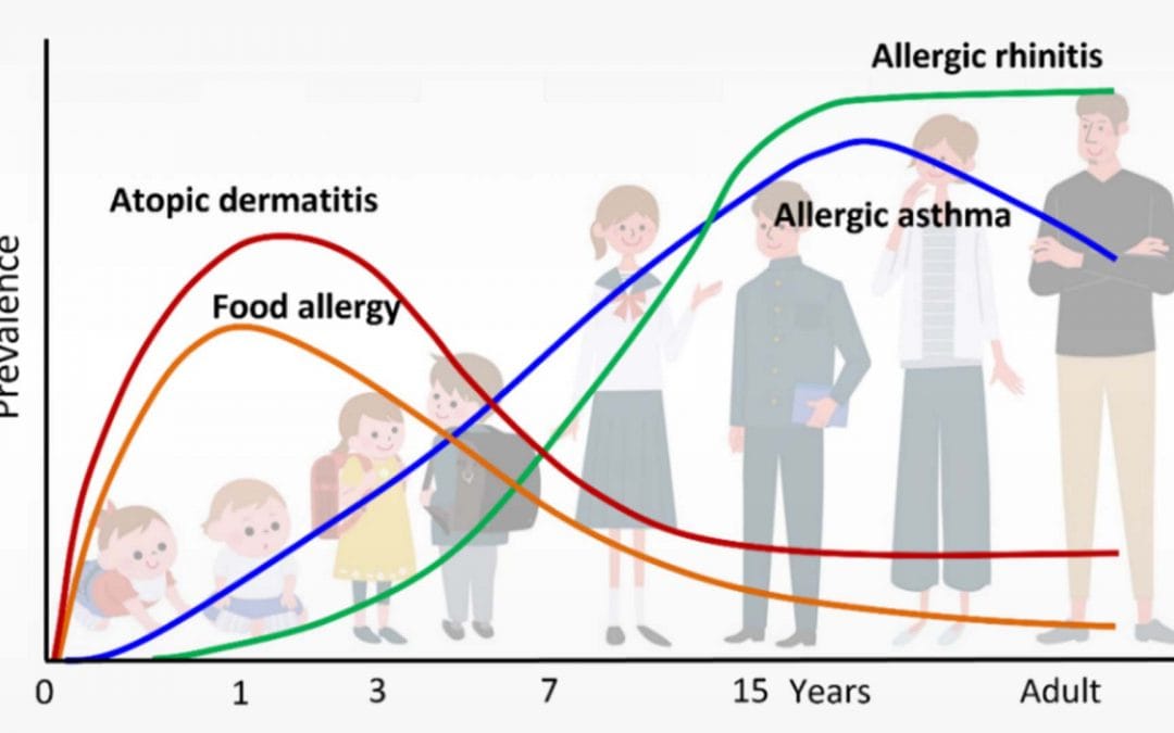 Addressing the Allergic March: Eczema, Food Allergies, Rhinitis, and Asthma