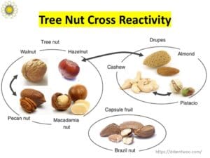 Tree Nut Allergy: Foods to Avoid, Cross-Reactivity & Hidden Sources