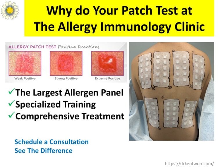 Patch Testing: Find Out What’s Causing Your Skin Allergy